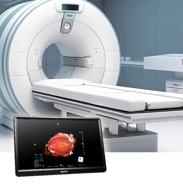 Newsroom Artikel Innolux mini LED display: New "Local Dimming ...